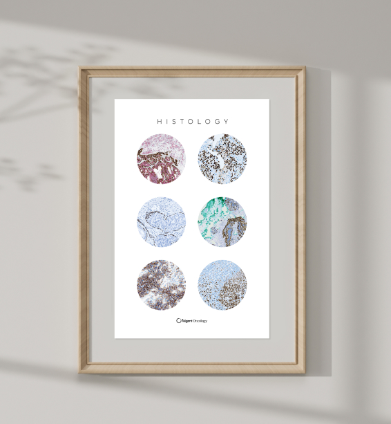 Fulgent Oncology | Pathology Your Way