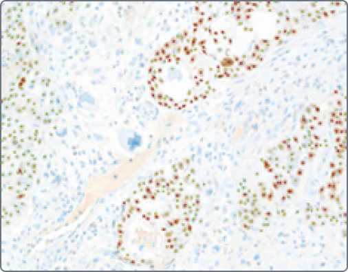 Fulgent FulScope | Fulgent Oncology